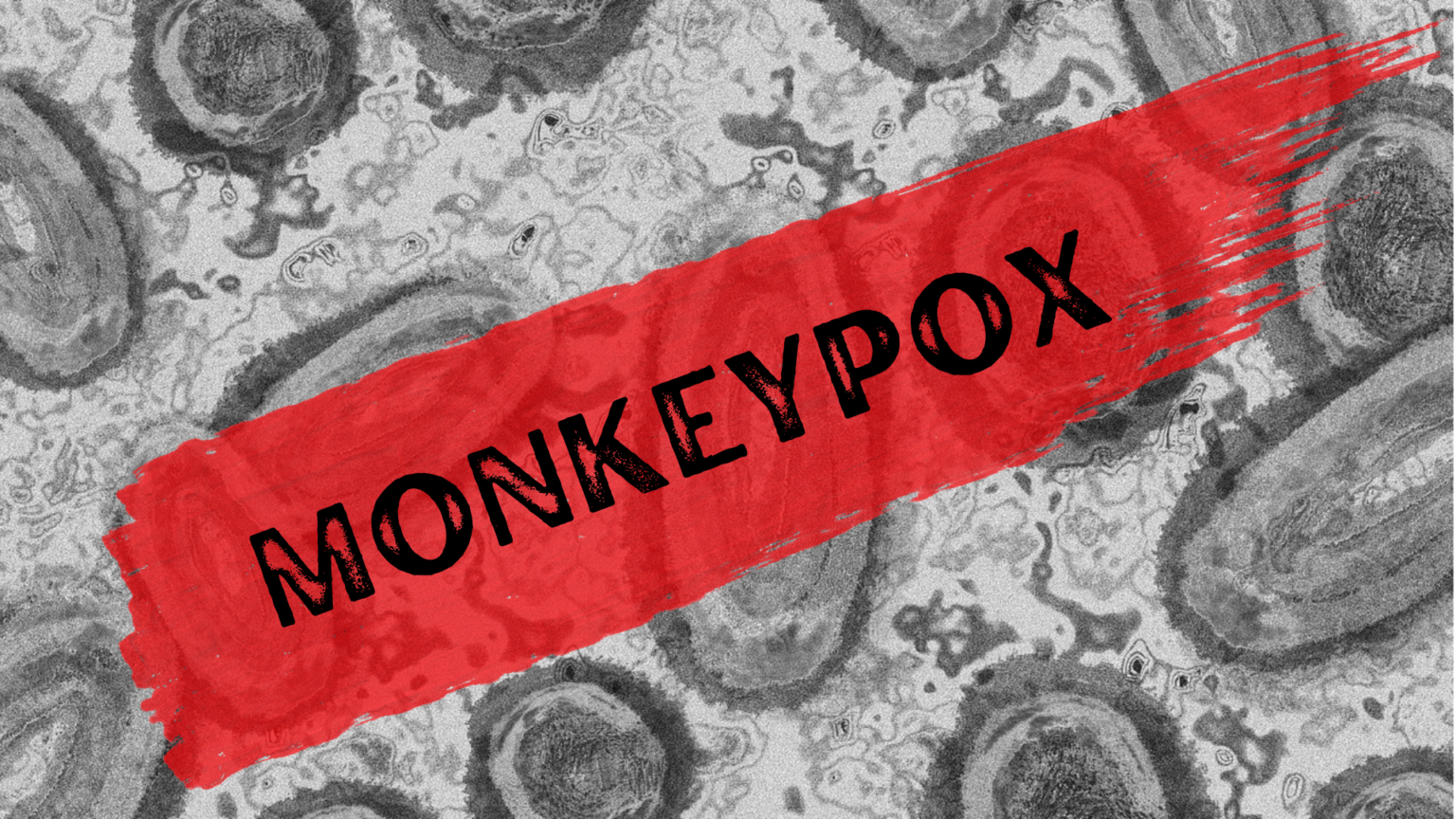 Monkeypox – Applying Lessons Learned to Improve an Equitable Global ...
